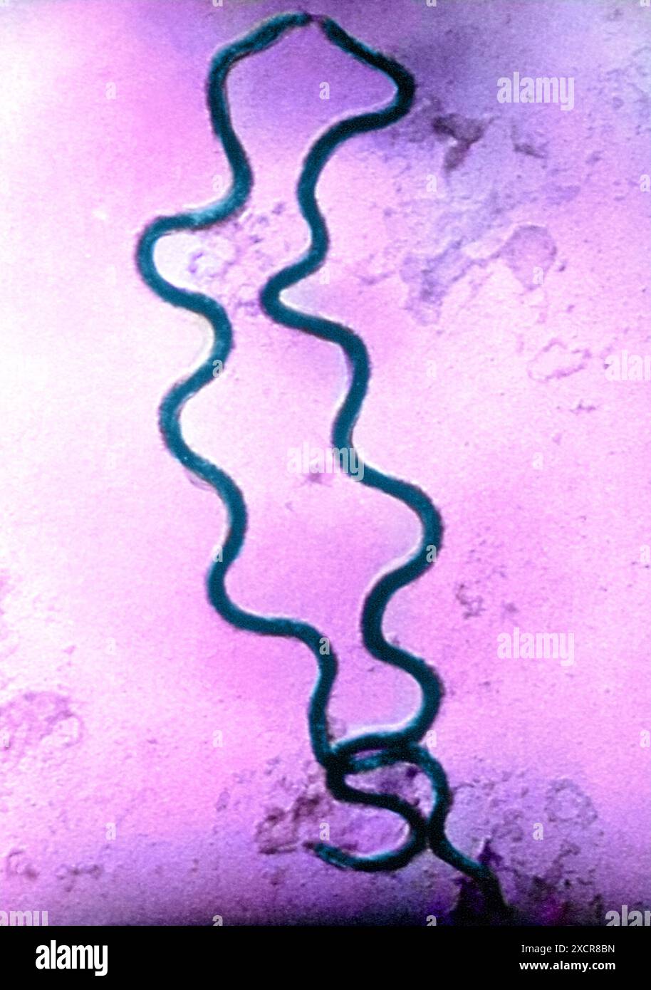 Treponema pallidum hi-res stock photography and images - Alamy