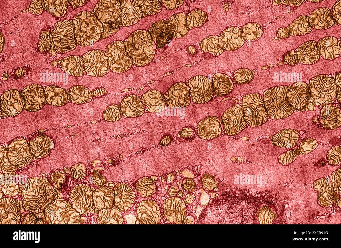 Cardiac muscle hi-res stock photography and images - Alamy