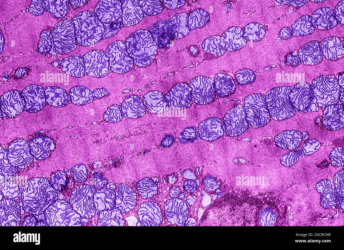 Cardiac muscle hi-res stock photography and images - Alamy