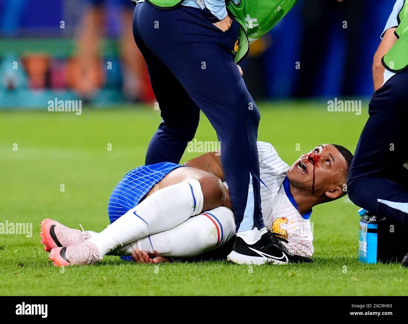 EDITORS NOTE: GRAPHIC France's Kylian Mbappe lies injured on the pitch ...