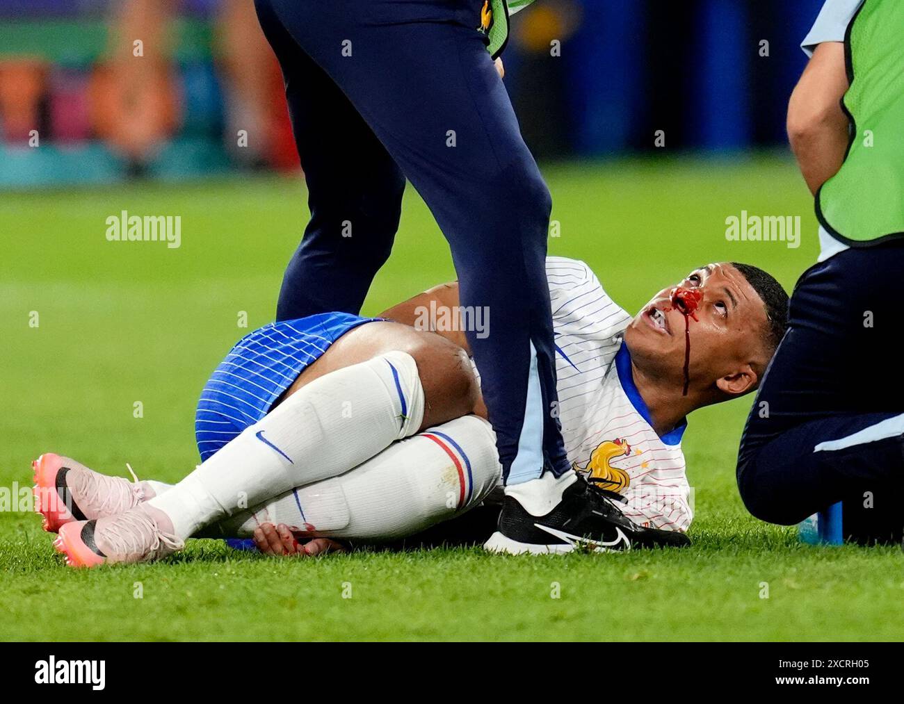 EDITORS NOTE: GRAPHIC France's Kylian Mbappe lies injured on the pitch ...