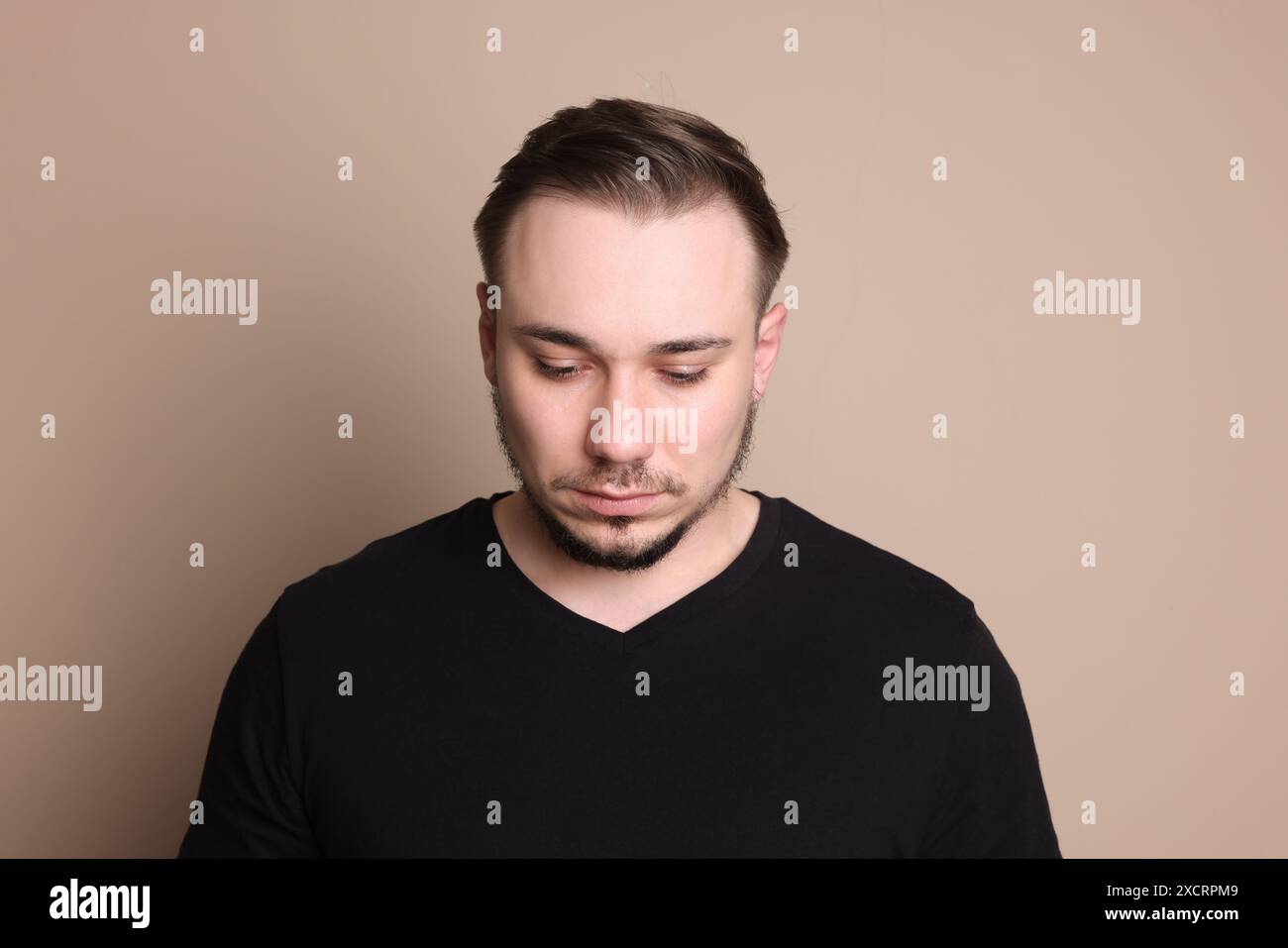 Baldness concept. Sad man with receding hairline on beige background ...