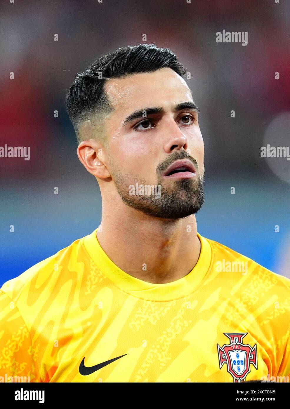 Portugal goalkeeper Diego Costa ahead of the UEFA Euro 2024 Group F ...
