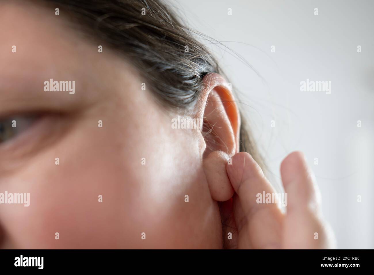 Acute ear hi-res stock photography and images - Alamy