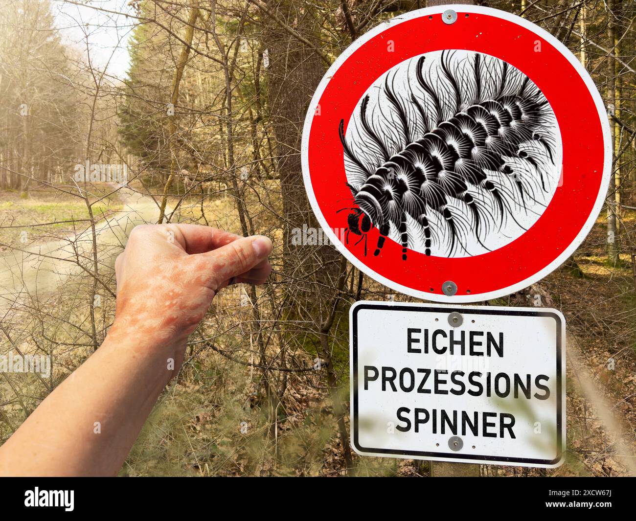 Allergie ausschlag hi-res stock photography and images - Alamy