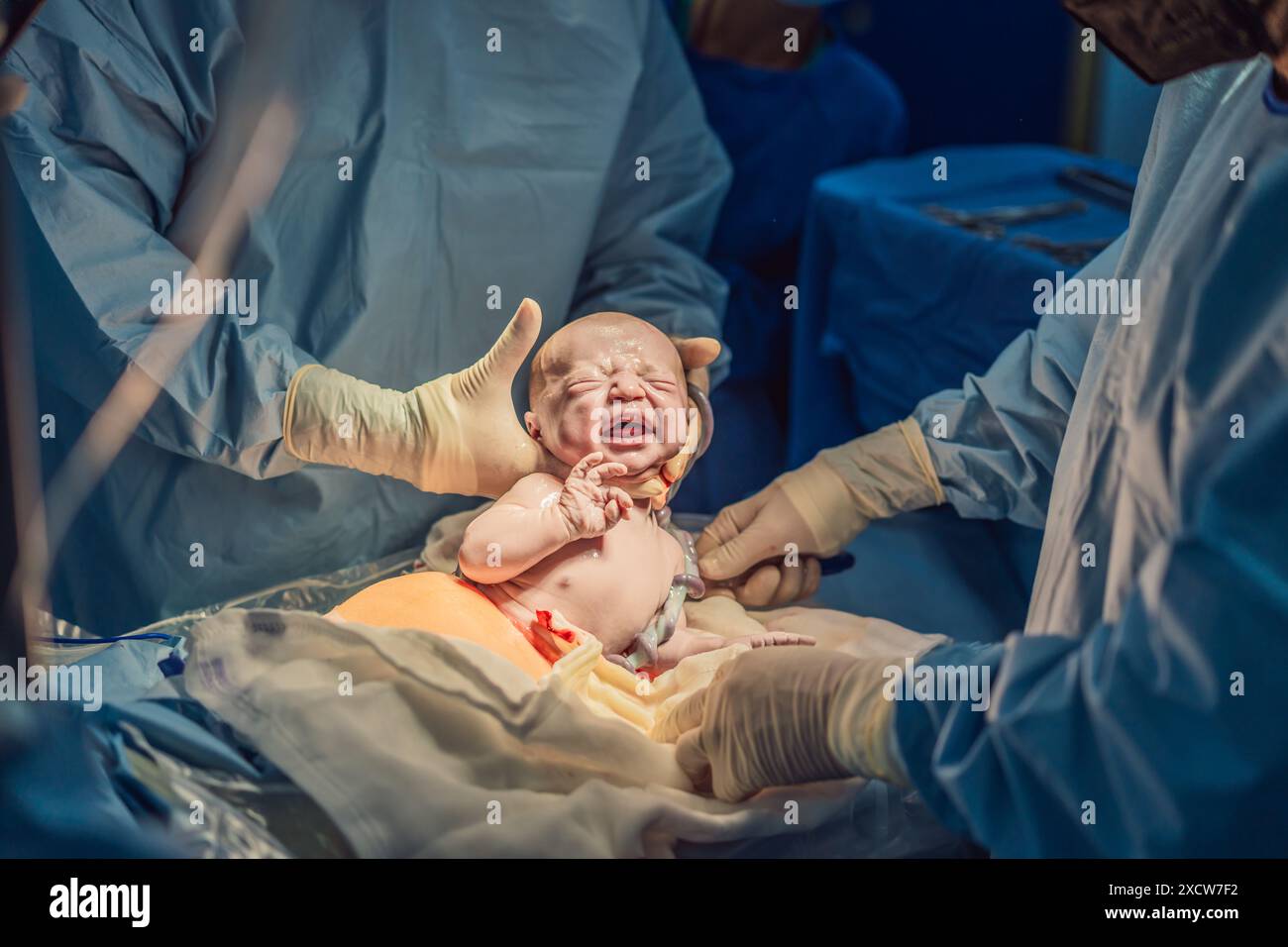 Surgical birth team hi-res stock photography and images - Alamy
