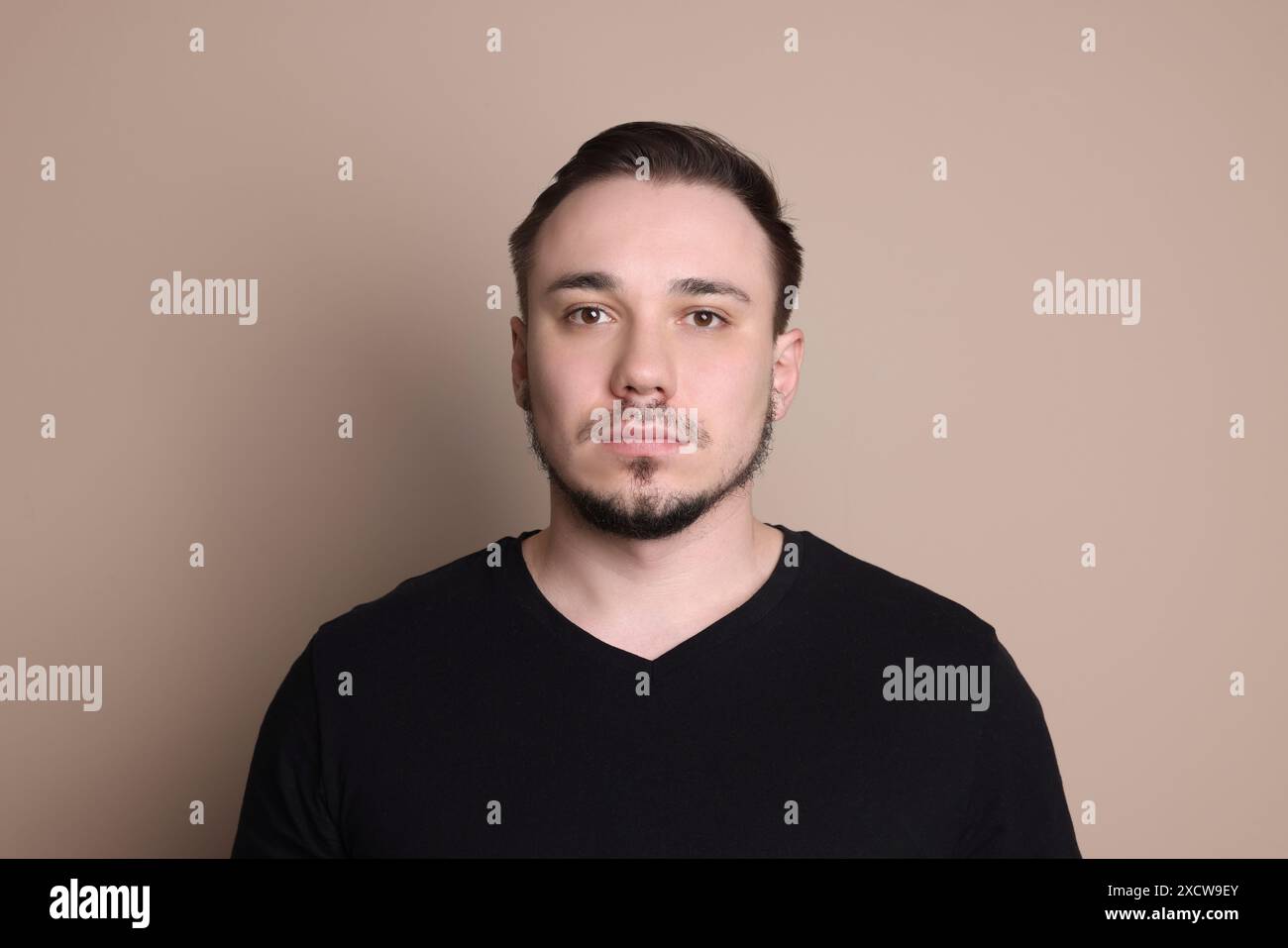 Baldness concept. Sad man with receding hairline on beige background ...