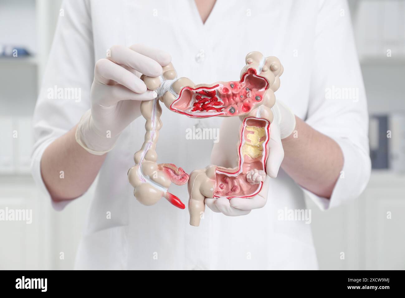 Doctor with model of large intestine in clinic, closeup Stock Photo - Alamy