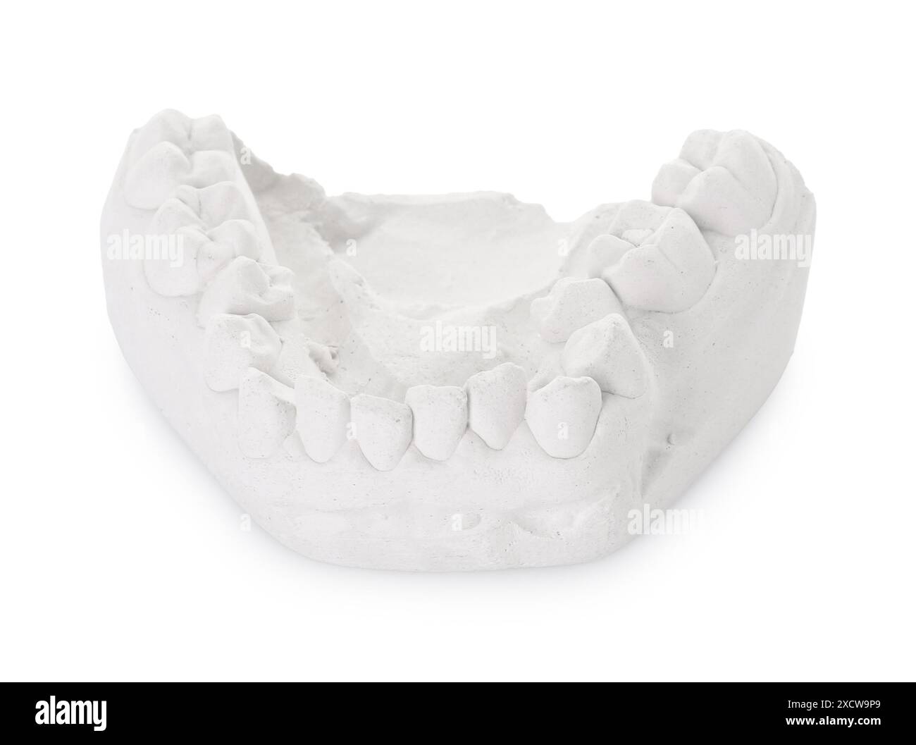 Dental model with gum isolated on white. Cast of teeth Stock Photo - Alamy