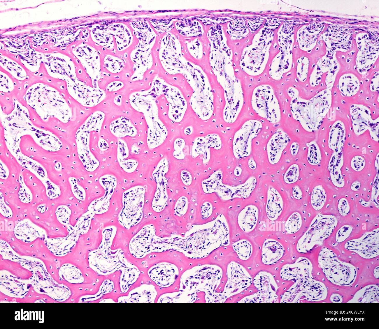 Light micrograph of a cross-sectioned immature bone (diaphysis). The ...