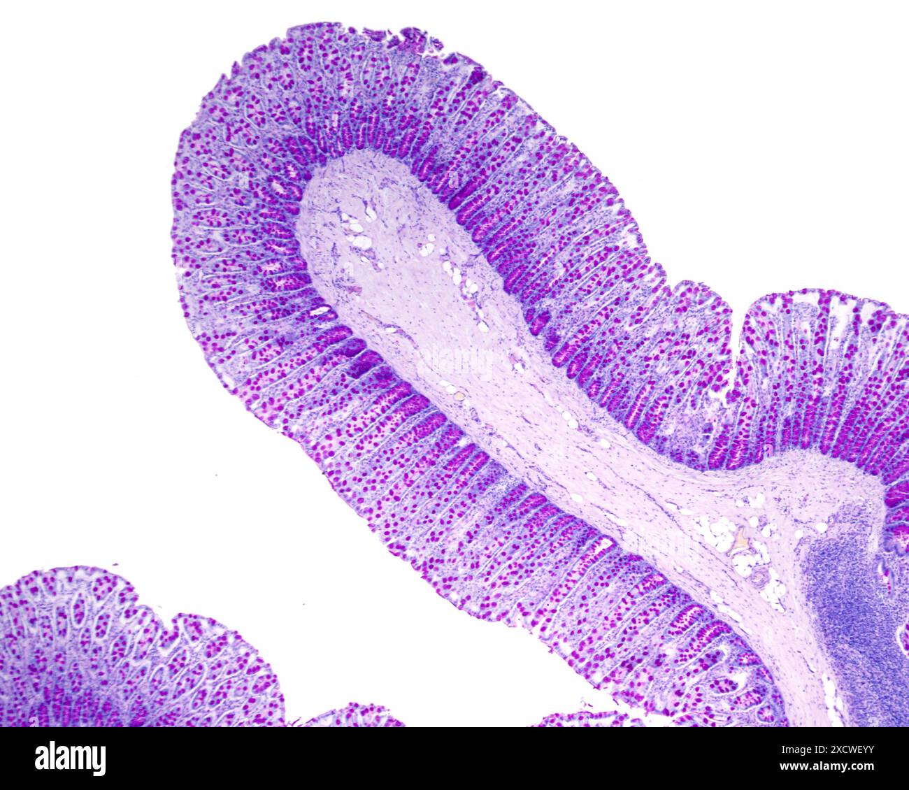 Human colon, light micrograph. The mucosa is devoid of villi, but has ...