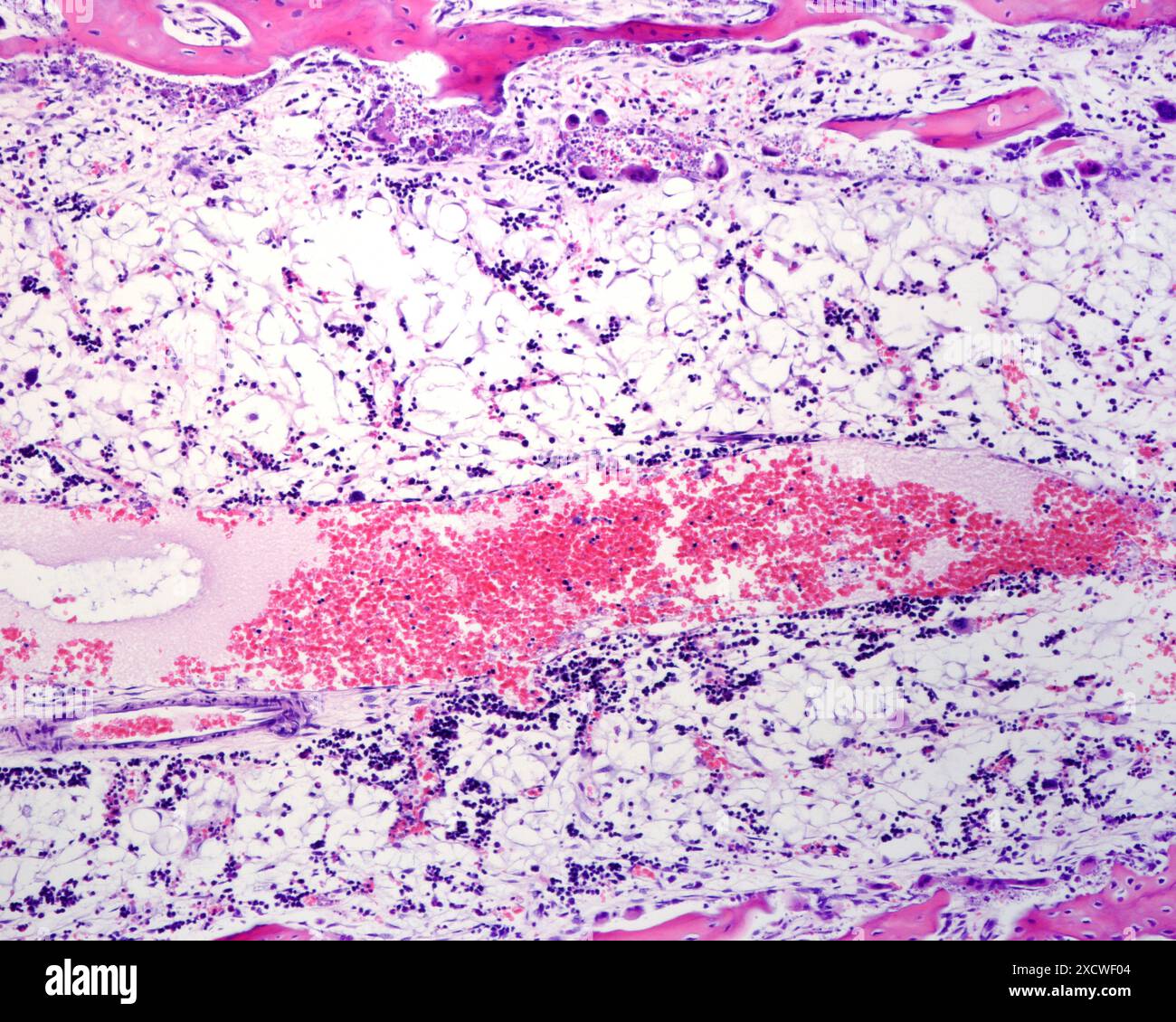 Bone diaphysis, light micrograph. Yellow bone marrow is a less active ...