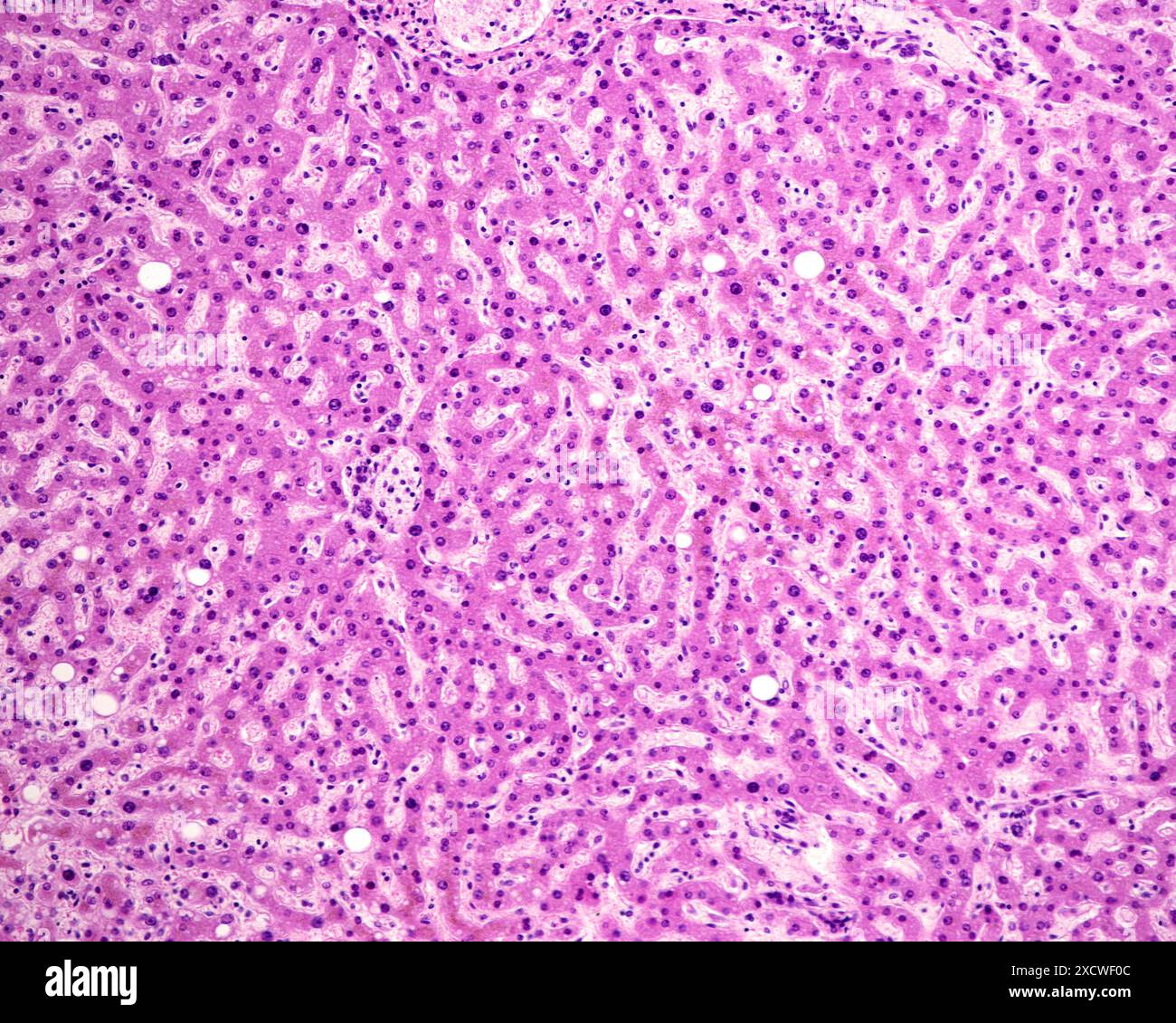 Human liver. Light micrograph showing hepatocytes (liver cells ...