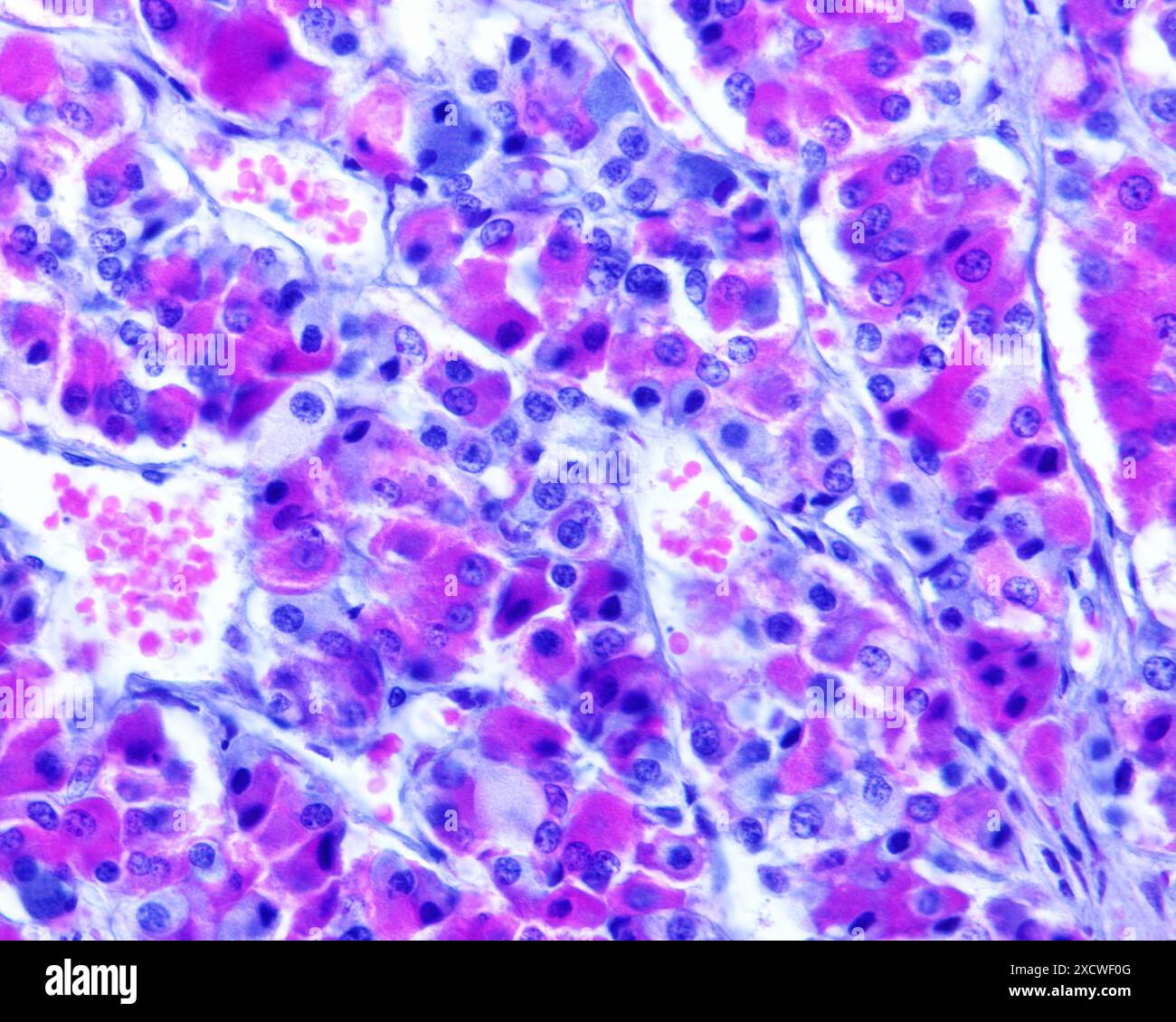 Light micrograph of an anterior human pituitary gland stained with ...