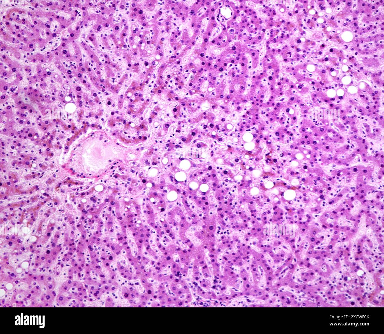 Human liver. Light micrograph showing hepatocytes (liver cells ...