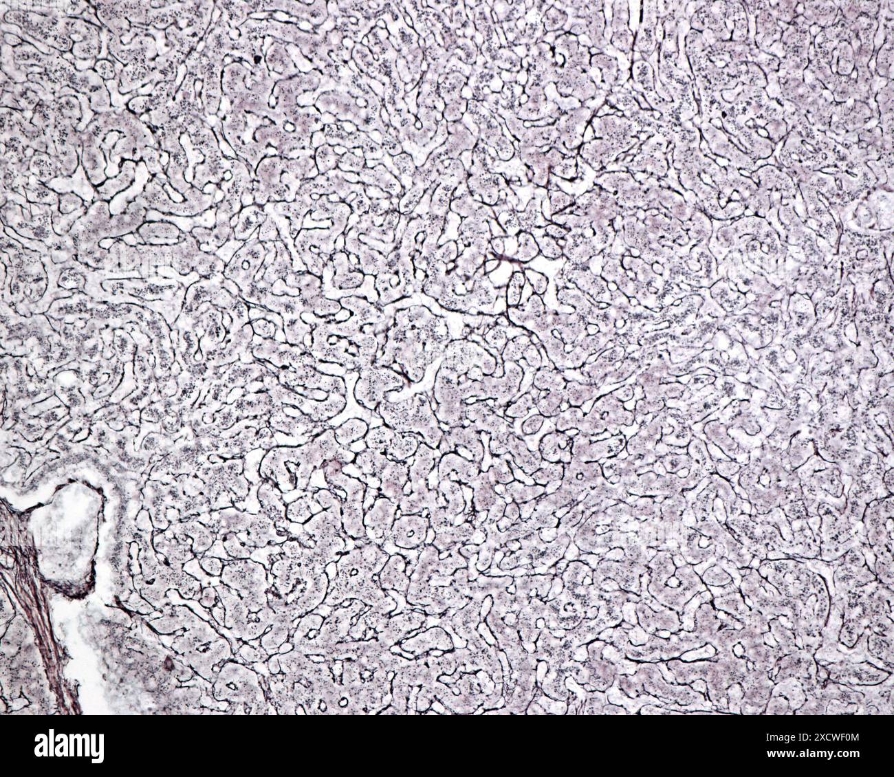 Human liver. Light micrograph showing the reticular fibre meshwork ...