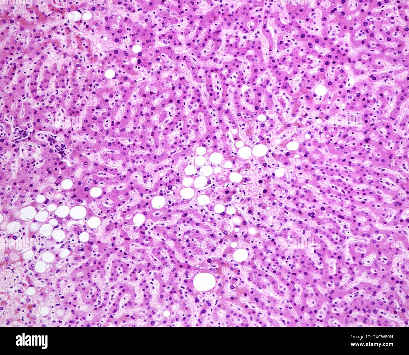 Human liver. Light micrograph showing hepatocytes (liver cells ...