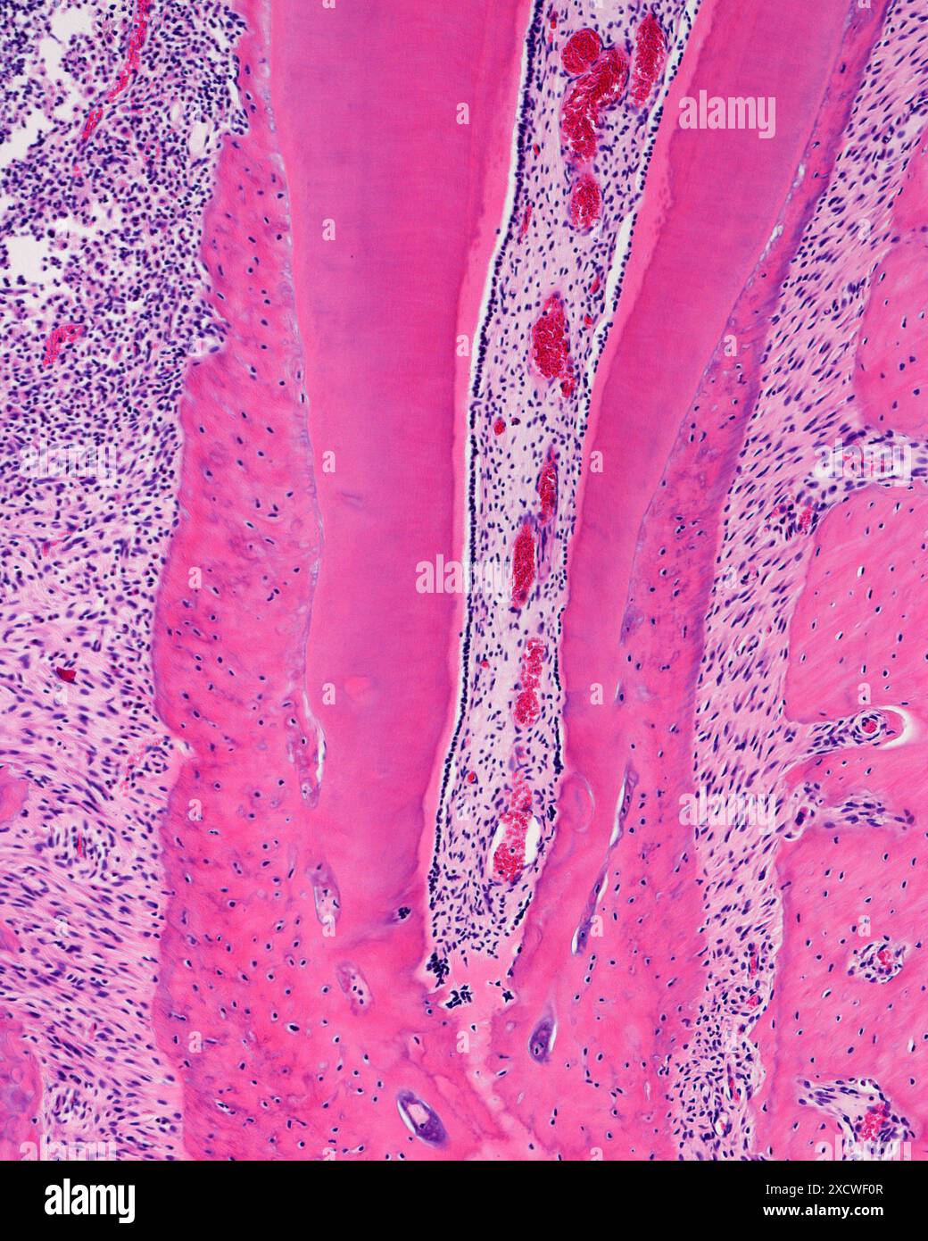 Light micrograph of a tooth root showing, from the centre: dental pulp ...