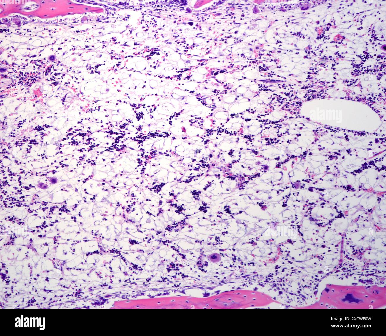 Bone diaphysis, light micrograph. Yellow bone marrow is a less active ...