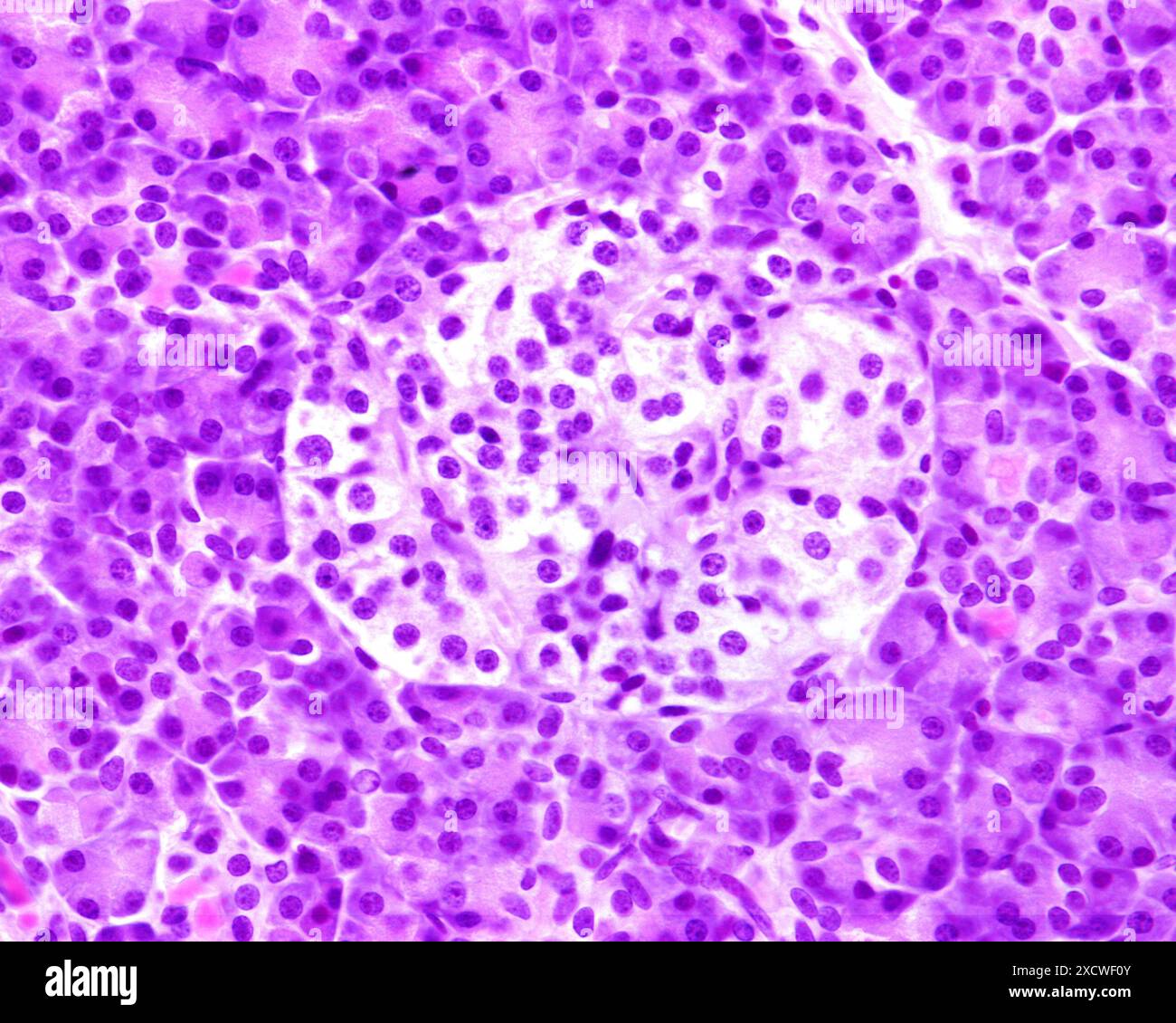 Light micrograph of a pancreas, showing the difference between exocrine ...