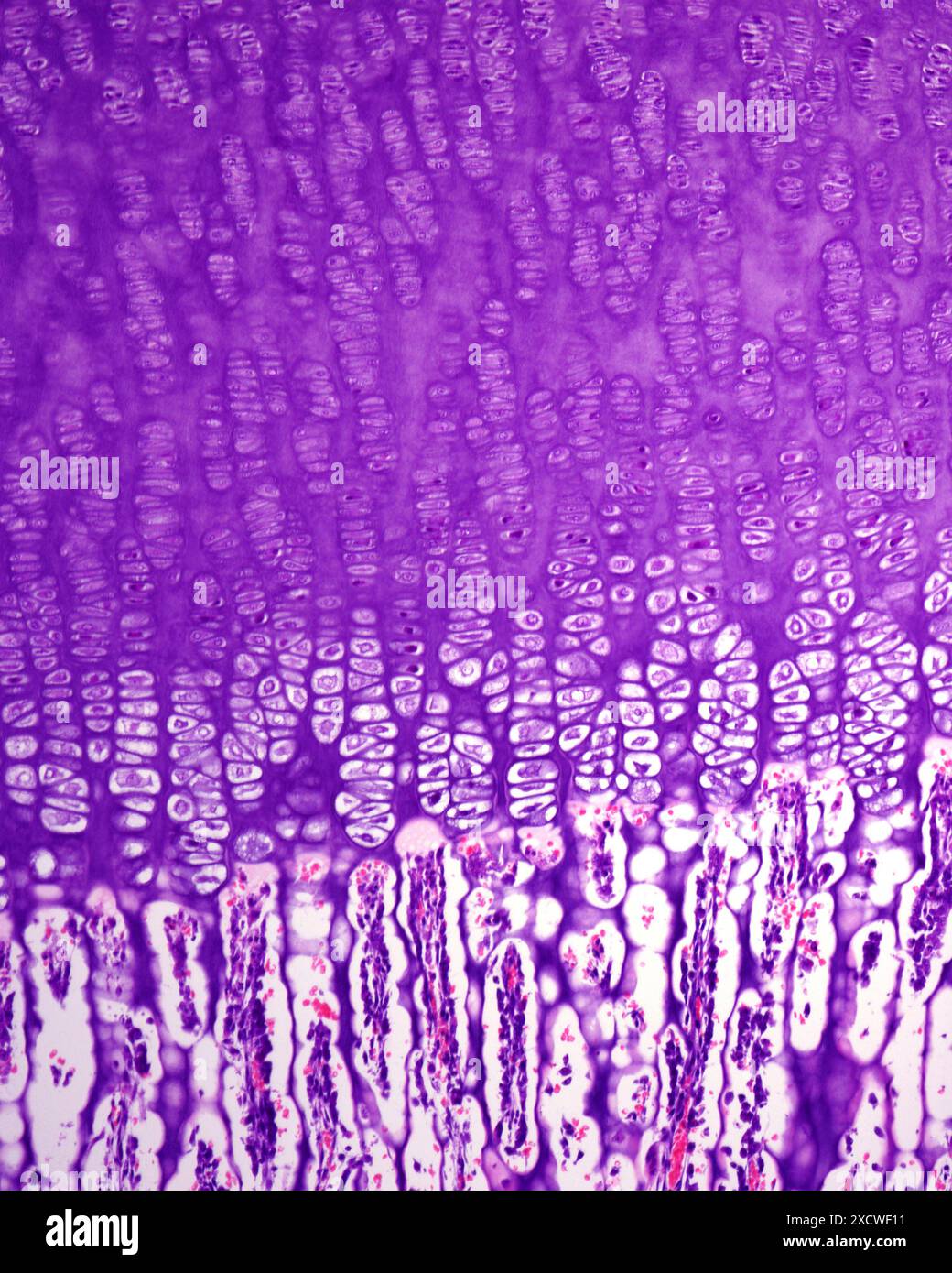 Light micrograph of the growth plate of a developing long bone. The ...