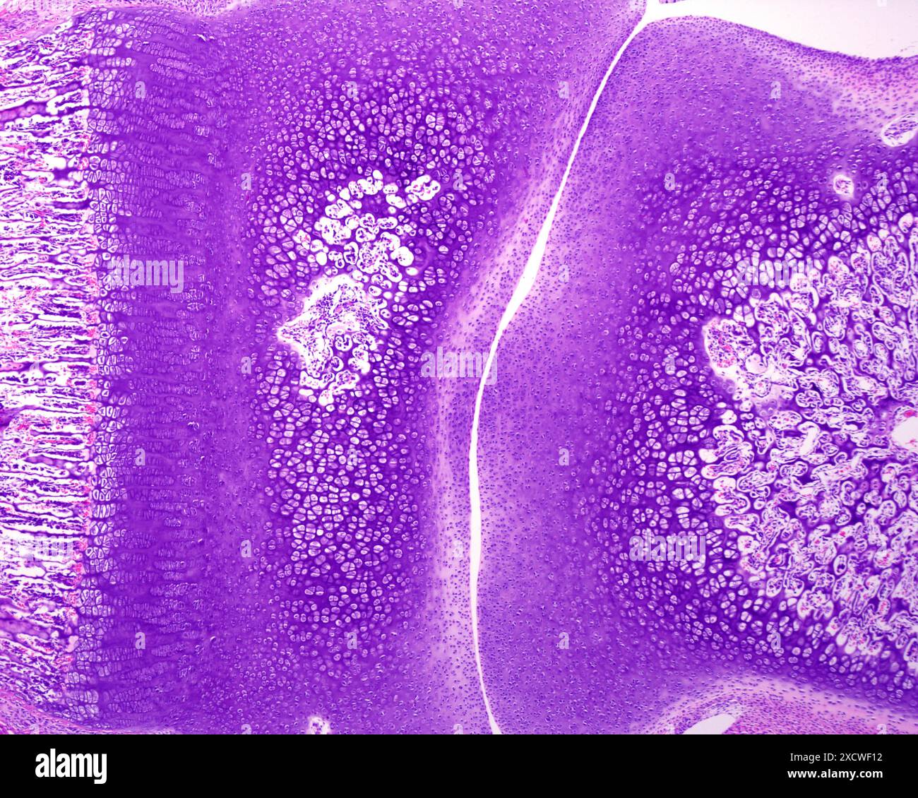 Light micrograph of a developing joint between two hand phalanges. The ...