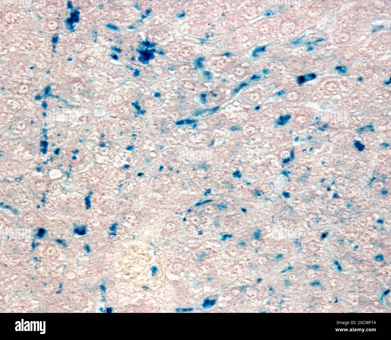 Light micrograph of Kupffer cells stained with Trypan blue. Kupffer ...