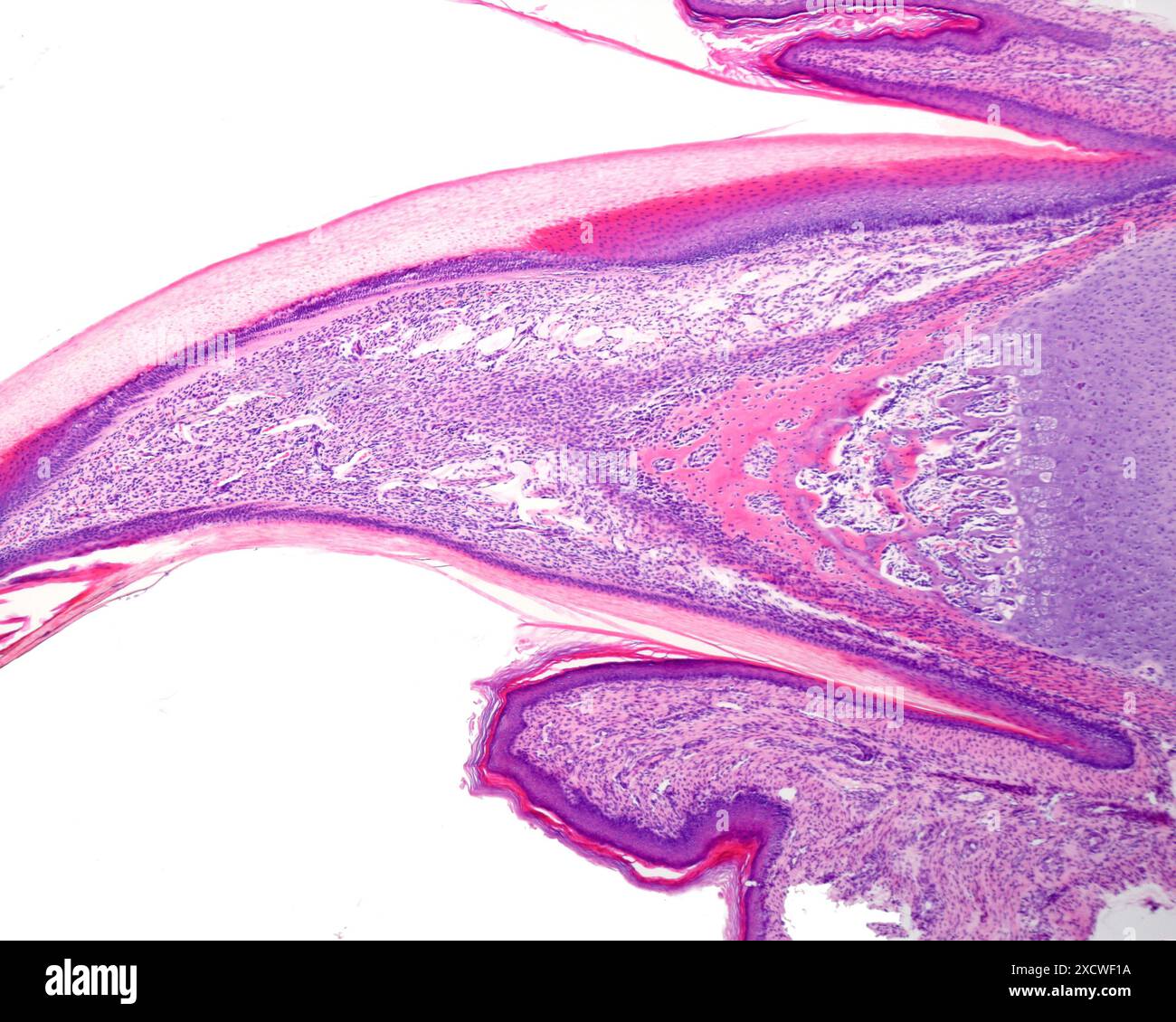 Light micrograph of the finger of an immature rabbit with developing ...
