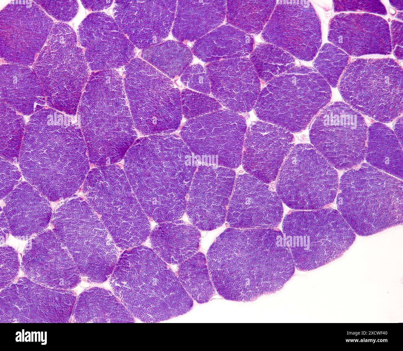 Light micrograph showing cross-sectioned skeletal muscle fibres. The ...