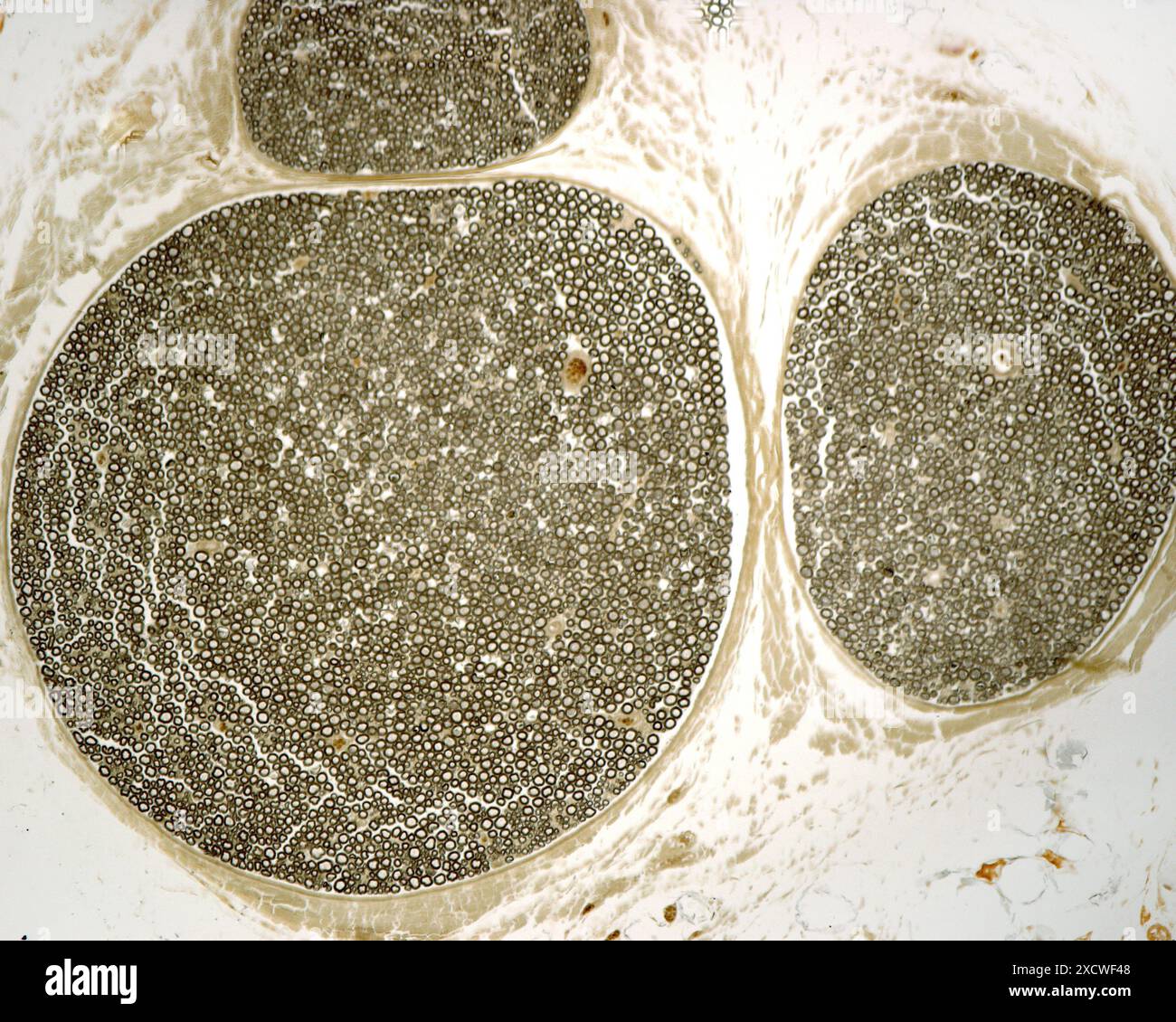 Light micrograph of cross-sectioned myelinated nerve fascicles stained ...