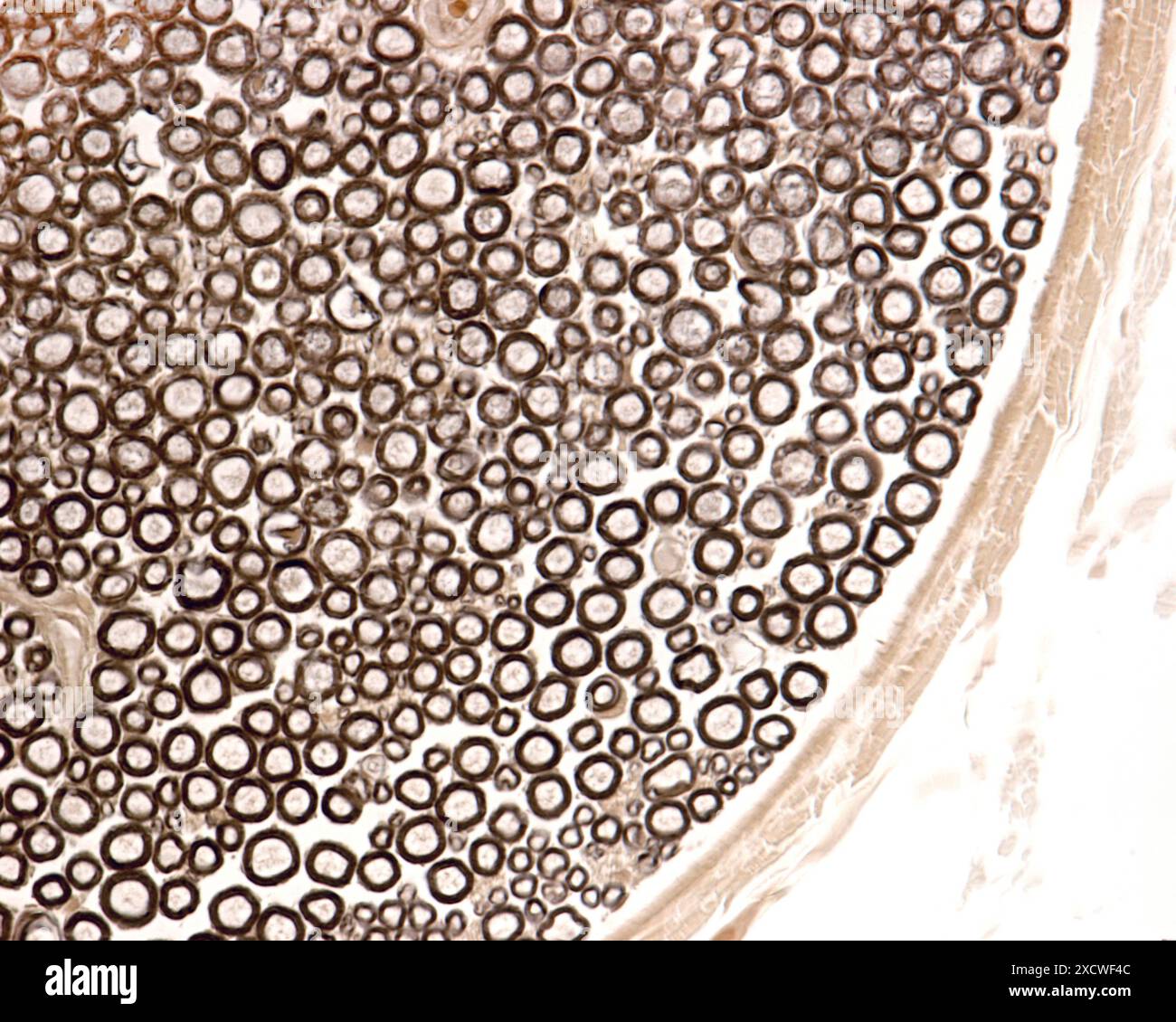 Light micrograph of a cross-sectioned myelinated nerve stained with ...