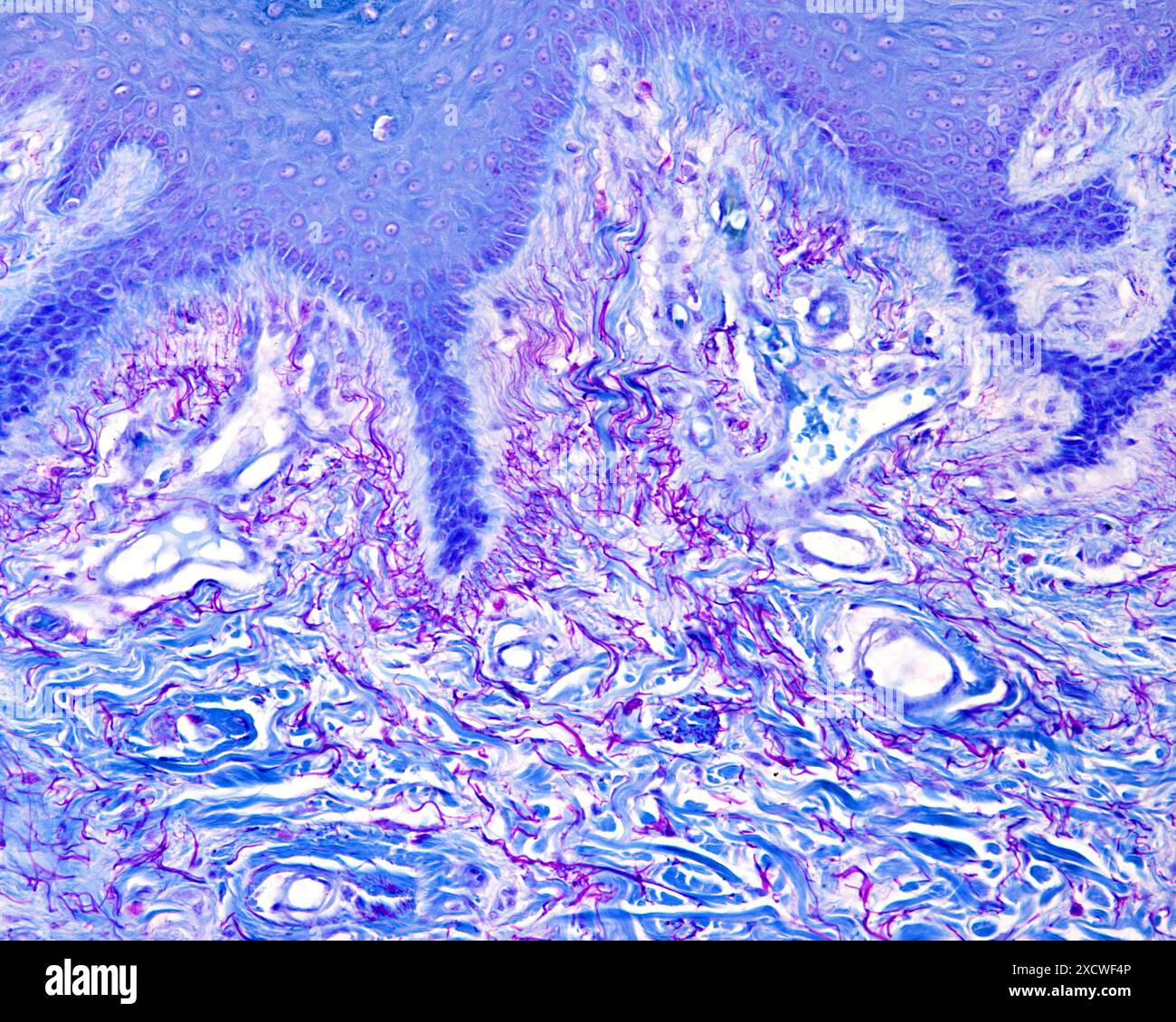 Light micrograph of papillary dermis from human skin, stained with the ...