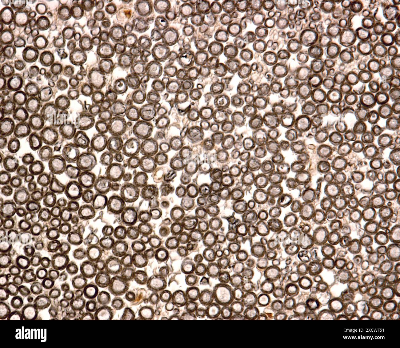 Light micrograph of a cross-sectioned myelinated nerve stained with ...