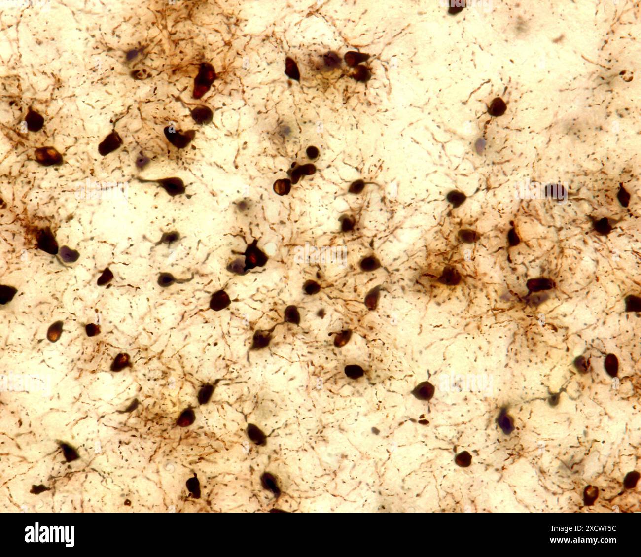 Light micrograph of oligodendroglia stained with the Rio-Hortega ...