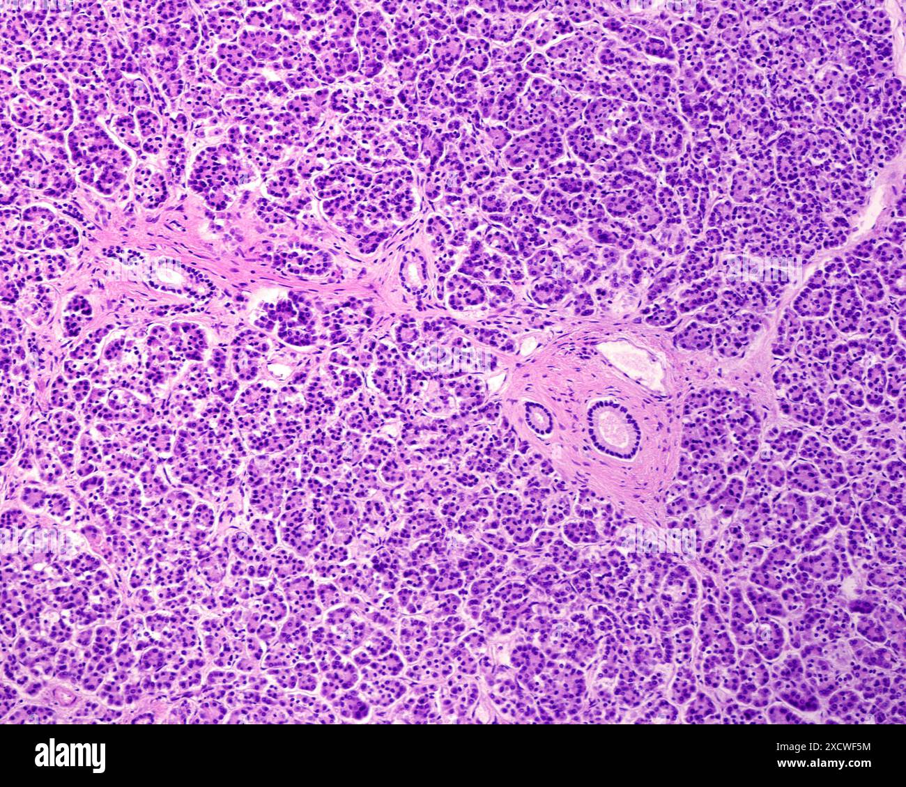 Light micrograph of a human pancreas. The exocrine acini occupy most of ...