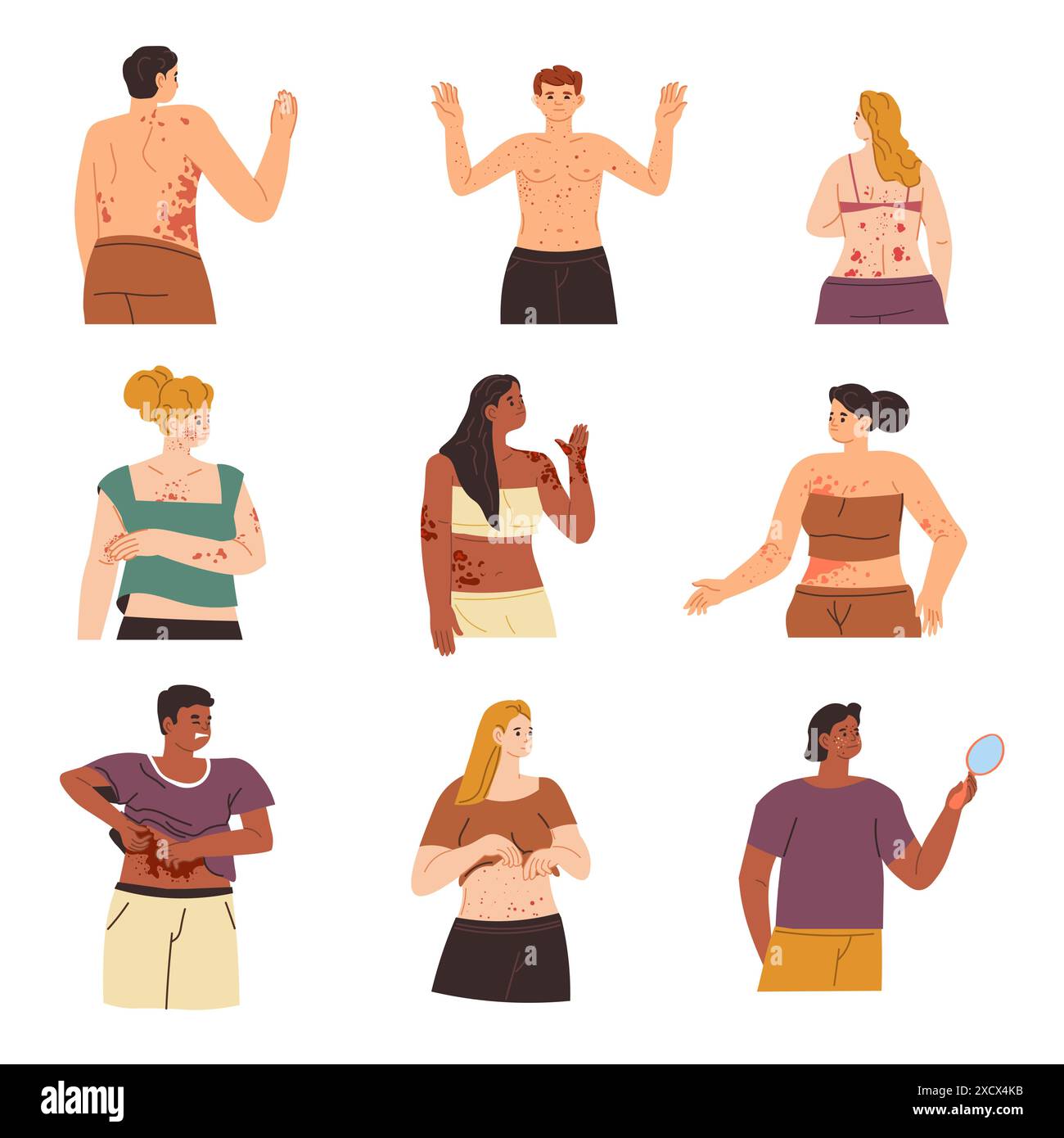 People with Skin Rash Set Stock Vector Image & Art - Alamy