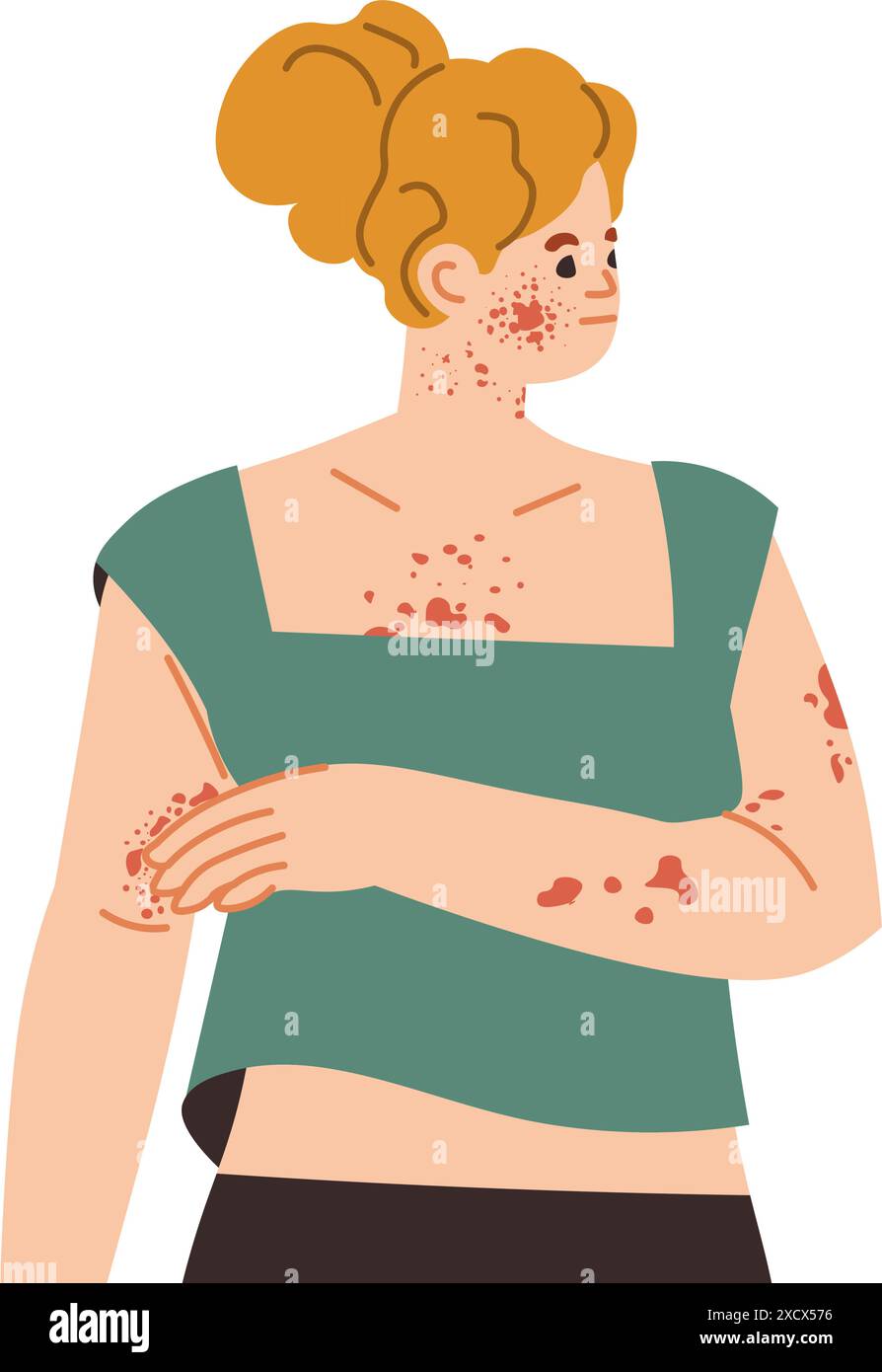 Woman with Rash on Arm vector Stock Vector Image & Art - Alamy