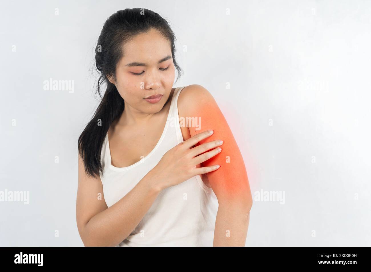 A woman with a red arm is holding her arm. She is wearing a white tank ...