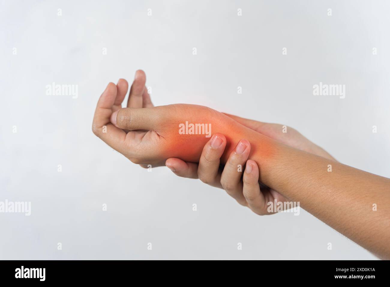 A person's hand is red and swollen, possibly from an injury. The hand ...