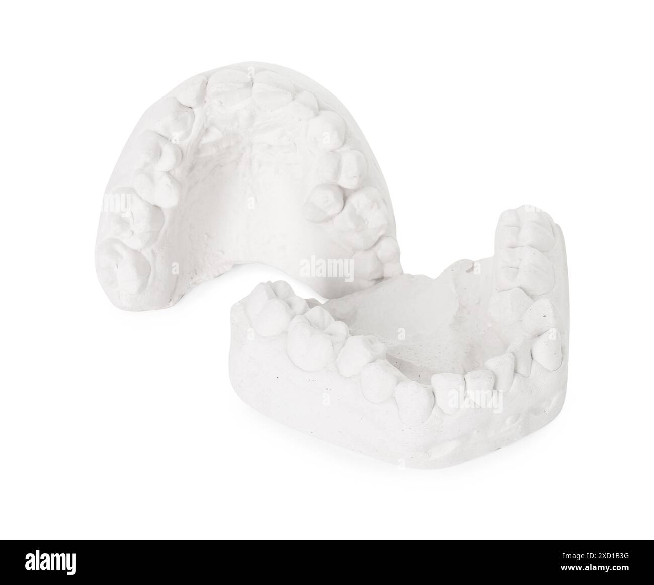 Dental model with gums isolated on white. Cast of teeth Stock Photo - Alamy