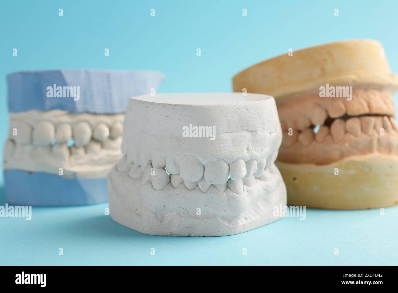 Dental models with gums on light blue background, closeup. Cast of ...