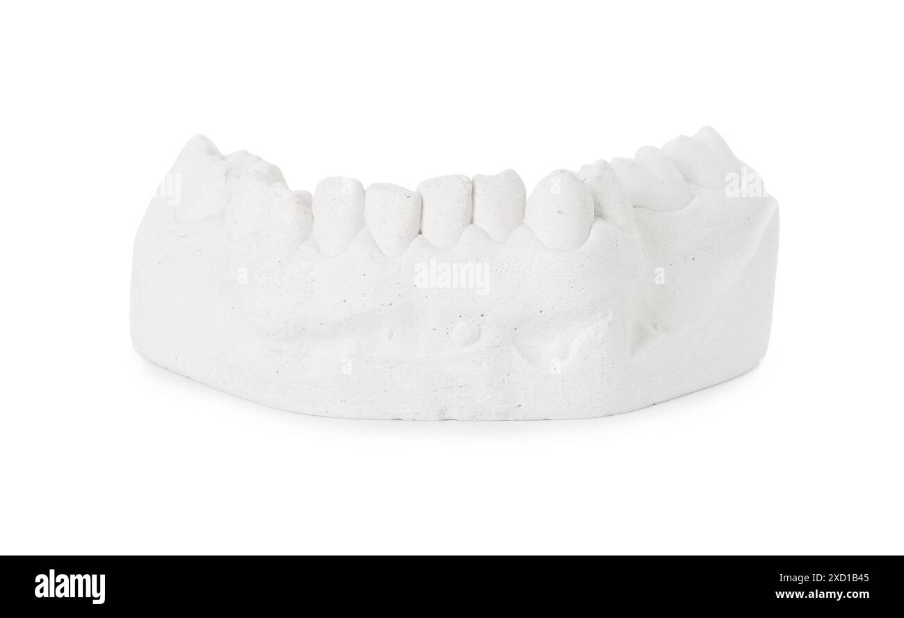 Dental model with gum isolated on white. Cast of teeth Stock Photo - Alamy