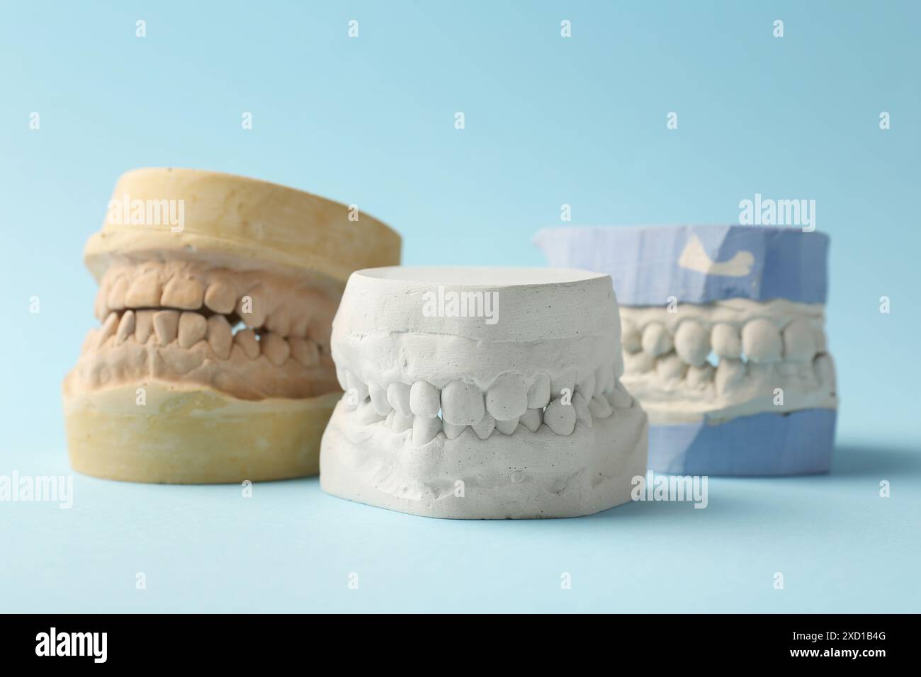 Dental models with gums on light blue background, closeup. Cast of ...