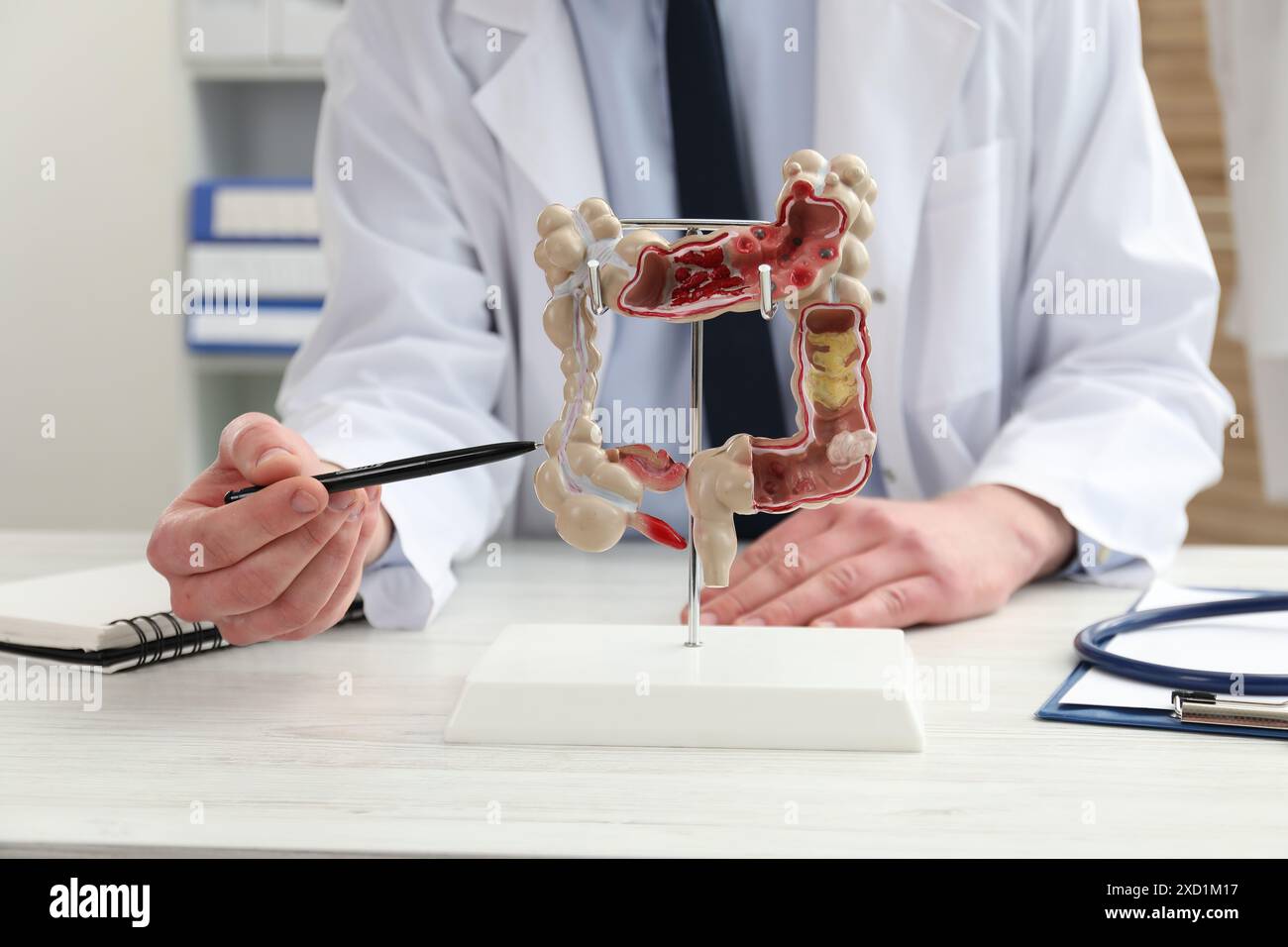 Doctor showing model of large intestine at white wooden table in clinic ...