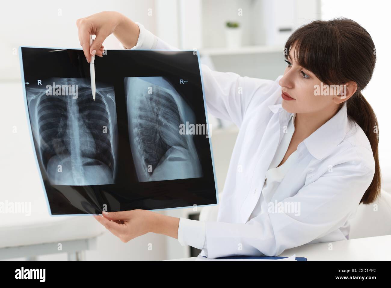 Lung disease. Doctor showing chest x-ray in clinic Stock Photo - Alamy