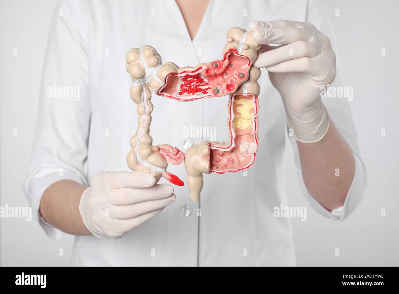 Doctor with model of large intestine on light grey background, closeup ...