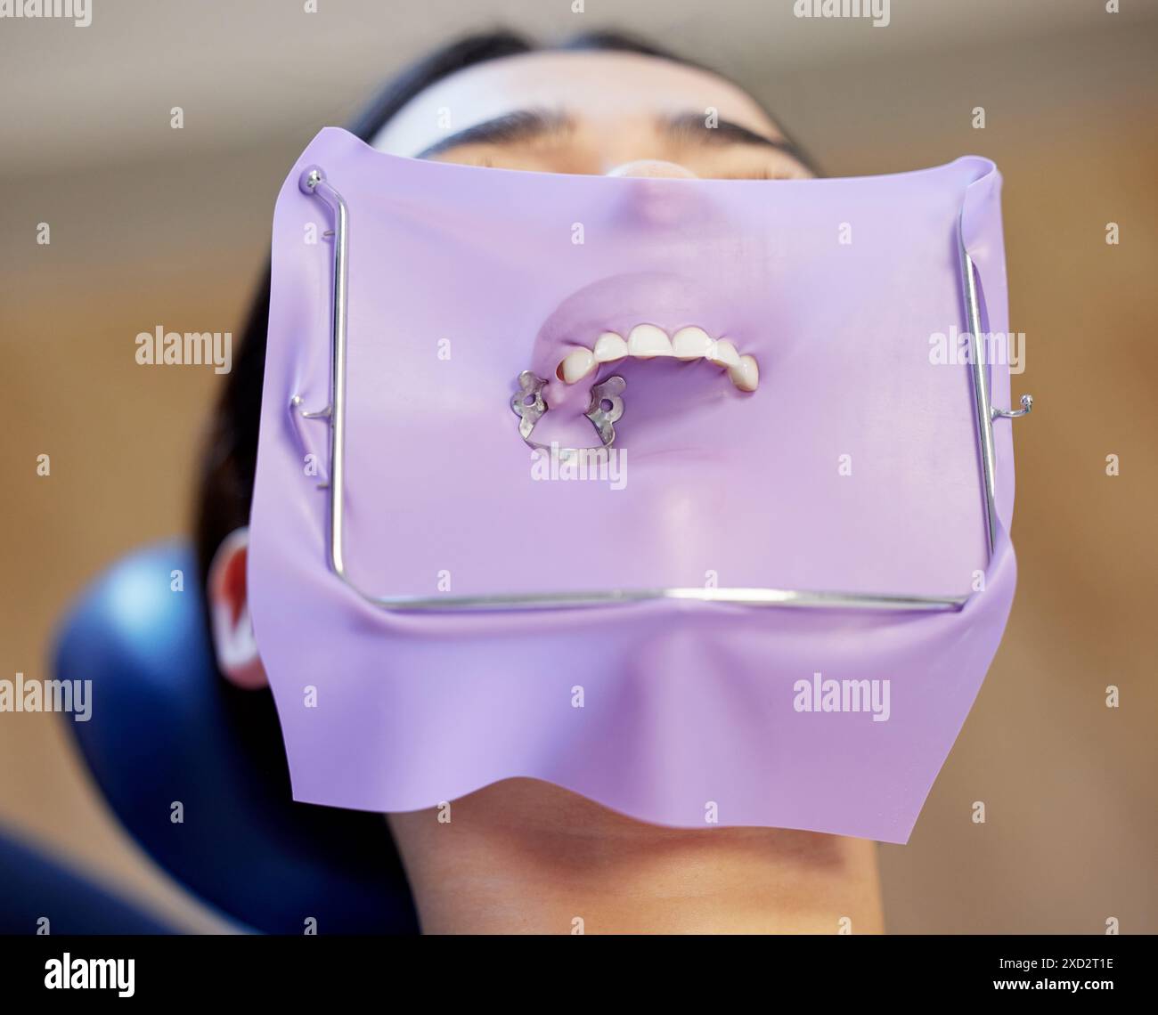 Dentist, dental and rubber dam for toothache in clinic, health and ...