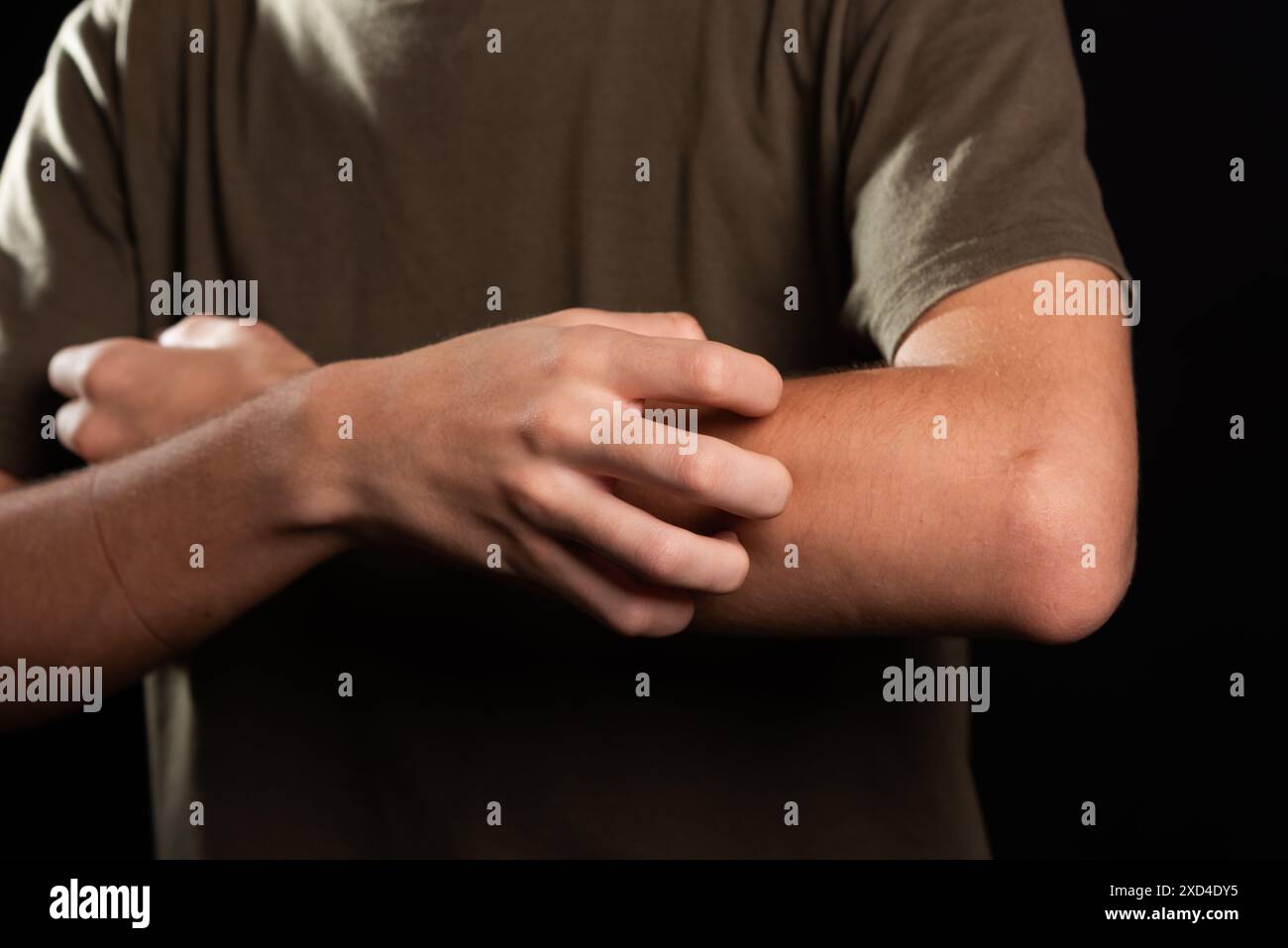 Young man scratching his arm with his hand. Skin disease. Irritation ...