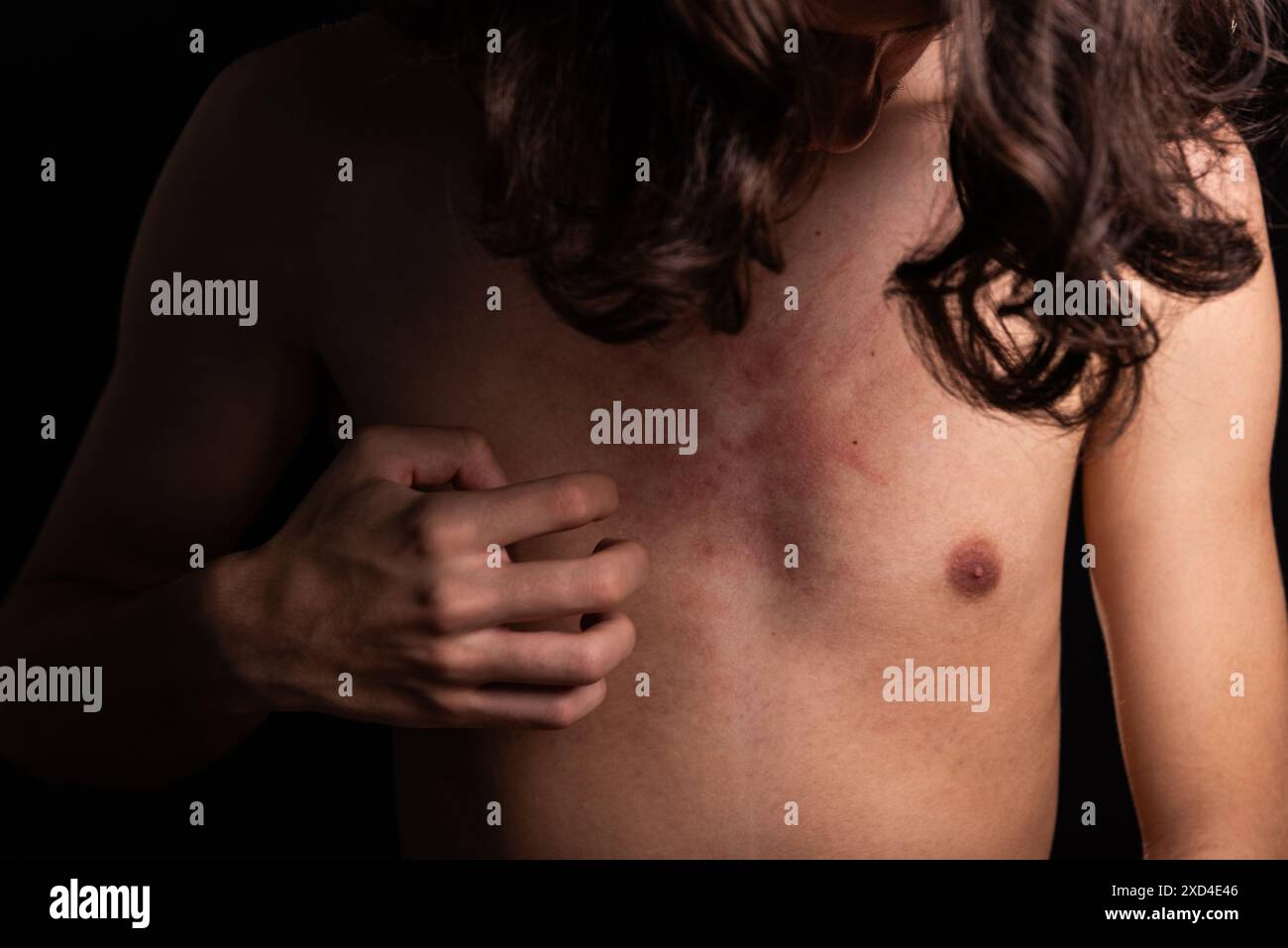 Chest of an angry man. Hand itching. Skin disease. Irritation, allergy ...