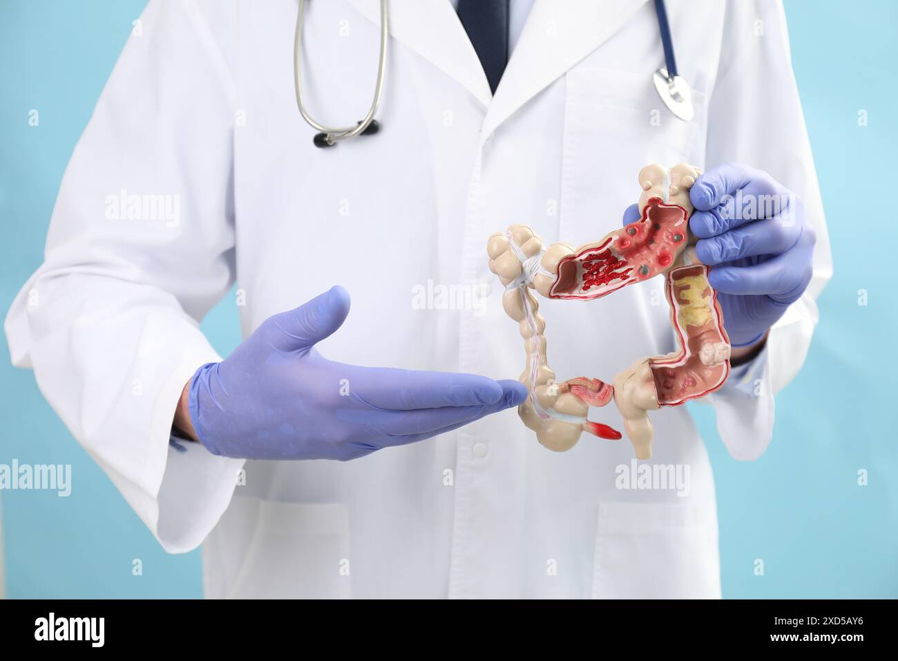 Doctor showing model of large intestine on light blue background ...